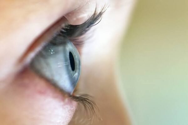 Retinitis Pigmentosa – Ayurveda Management | Ayurdhama